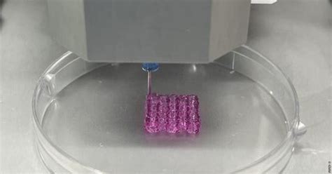 3d Bioprinting Technology To Be Used For Removing Cancer Cells