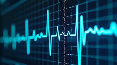 Ecg Part Vii The Qrs Complex