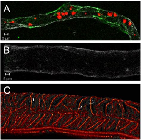 A Example Of Molecular Imaging Using Adherent Microbubbles Red To Download Scientific