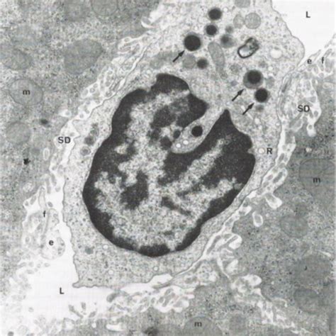 An Endothelial Cell Surrounding The Sinusoidal Lumen The Endothelial
