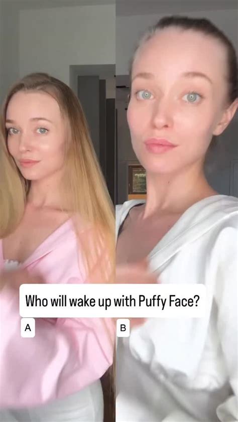 Talk About Hard Worker The Orbicularis Oculi The Circular Muscle