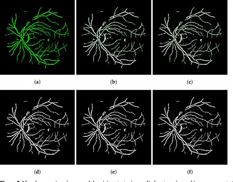 Figure 2 From A Fully Unsupervised Deep Learning Framework For Non