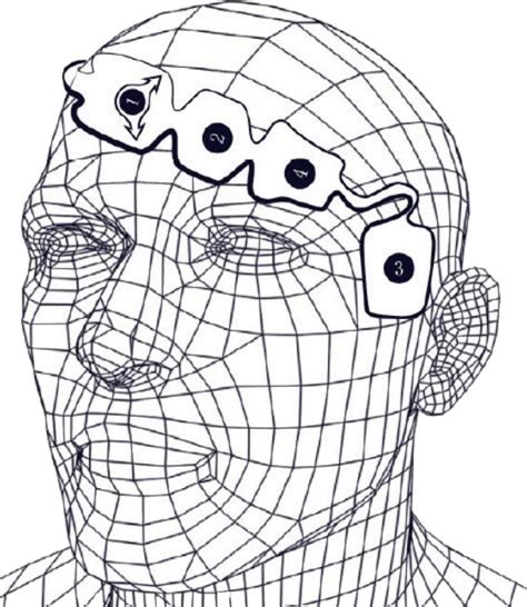 Patient Monitoring With Bispectral Index Eeg Sensors Viamed Ltd