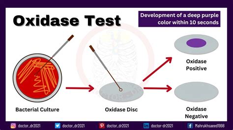 Oxidase Test In Microbiology Everything You Need To Know