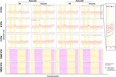 Hla Typing Of Two All Patients Performed By Ngs Typing Views From The Download Scientific