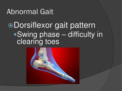 Ppt Gait Powerpoint Presentation Free Download Id6639544
