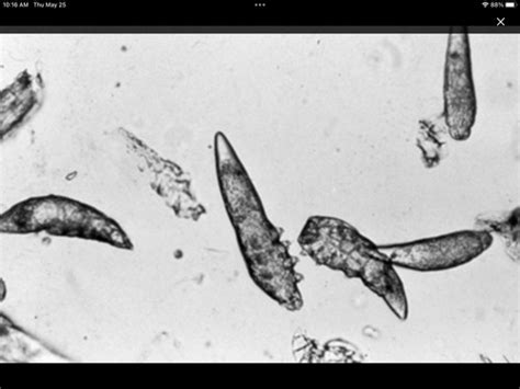 Parasitology Endoparasites And Ectoparasites Flashcards Quizlet