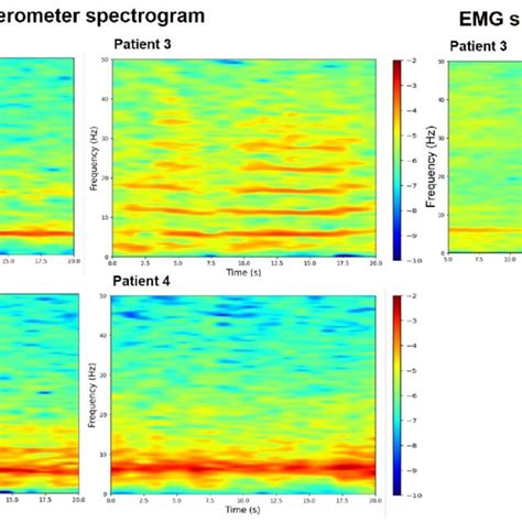 Plot Revealing Time Frequency Spectrogram Of Tremor Power For Plot Revealing Time Frequency Spectrogram Of Tremor Power For