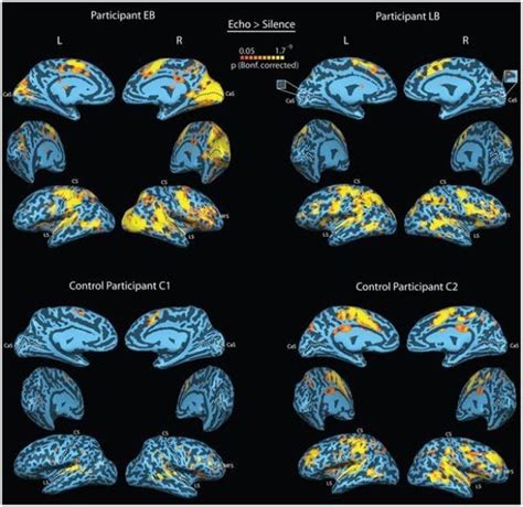 Human Echolocation How The Blind Can See