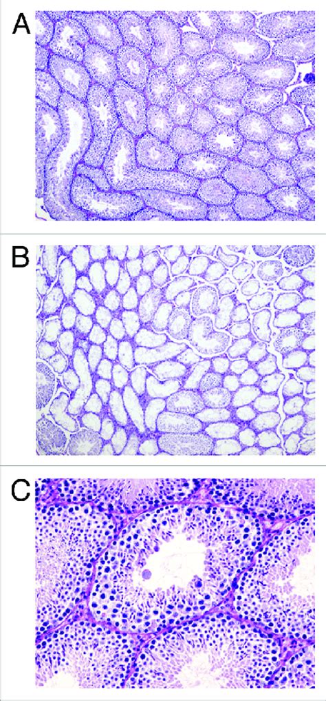 Spermatogenesis Is Defective In 50 80 Of The Seminiferous Tubules Of Download Scientific