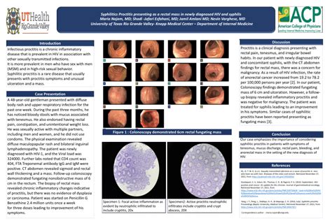 Pdf Syphilitics Proctitis Presenting As A Rectal Mass In Newly