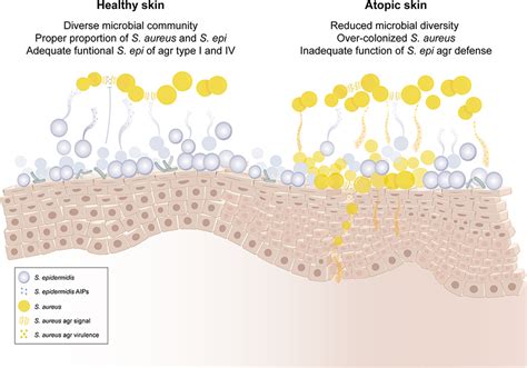 Heterogeneous Regulation Of Staphylococcus Aureus By Different Staphylococcus Epidermidis Agr