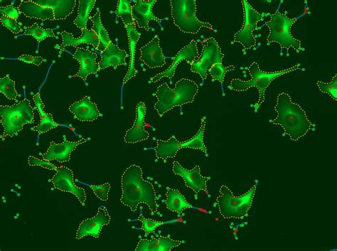 2d Automated Analysis Image Pro Media Cybernetics 2d Automated Analysis Image Pro Media Cybernetics