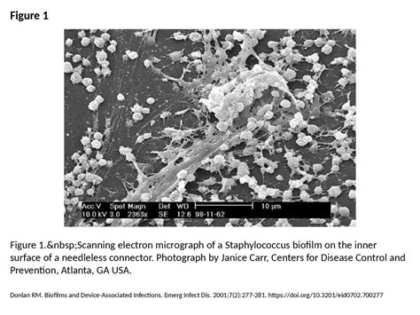 Ppt Figure 1 Figure 1 Scanning Electron Micrograph Of A Staphylococcus Biofilm On