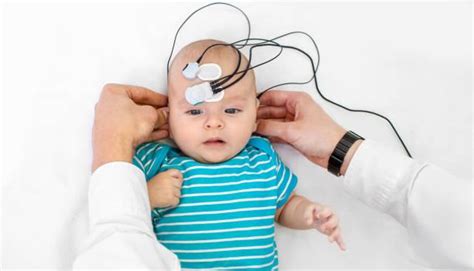 Auditory Brainstem Response Abr Audi Hearing