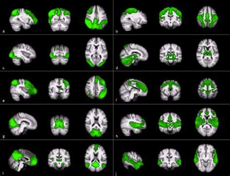 A Right Working Memory X ϭ 31 Y ϭ Ϫ 52 Z ϭ 39 B Dorsal Download Scientific Diagram