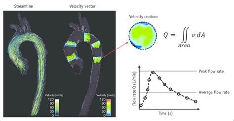 Velocity Visualization And Quantification Of Flow Rate Streamline And