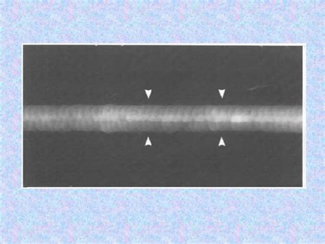 Types Of Radio Graphic Rt Weld Examination Defects Ppt Medical Tests Medical Health