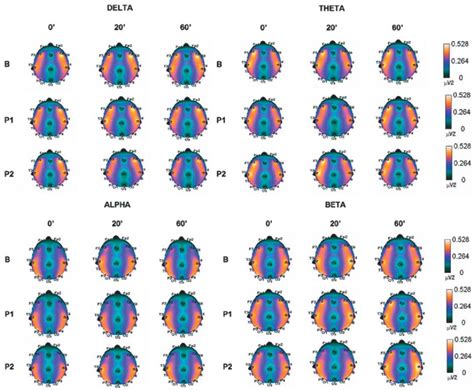 Cortical Dynamics Of Eeg Relative Power Variation Across Conditions