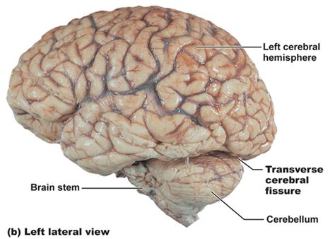 Transverse Fissure Brain Brain Nervous System And Sensory System