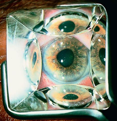 Pin De Cristhian Maria Jirón Aguirre En Oftalmo Anatomía Del Ojo Optica Y Optometria Optometría