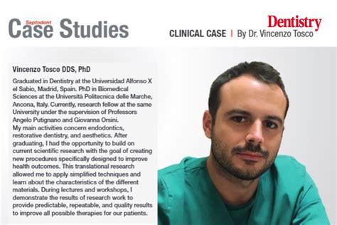 Direct Pulp Capping With The Bio Bulk Fill Technique Dentistry