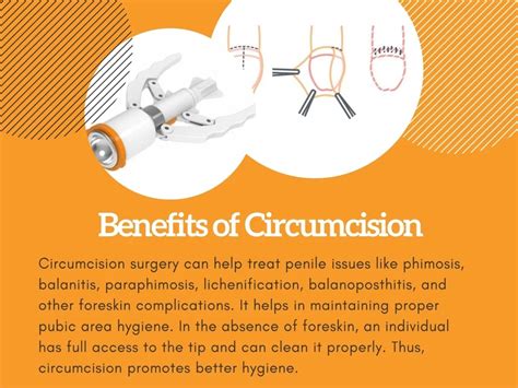 Ppt Quick Facts You Need To Know About Laser Circumcision Surgery