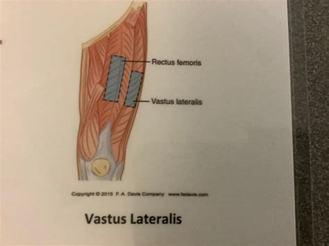Medication Administration Flashcards Quizlet