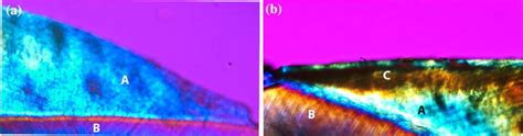 Polarised Microscope Photomicrographs Of Tooth Sections At The Crown