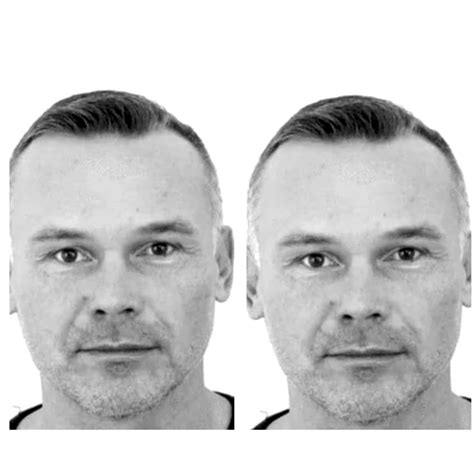 Radoslav Kunzo Health What Health Condition Did Radoslav Kunzo Have