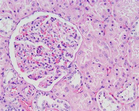 Simple Squamous Epithelial Tissue Under Microscope Simple Squamous Epithelial Tissue Under Microscope