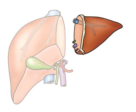 Information For Potential Living Liver Donors Leeds Teaching