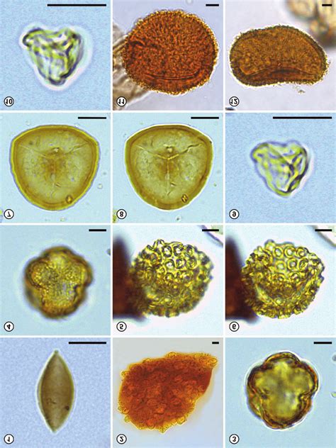 1 Closterium Sp Mpm Pb 21664 C55 3 2 Botryococcus Sp Mpm Pb 21651 Download Scientific