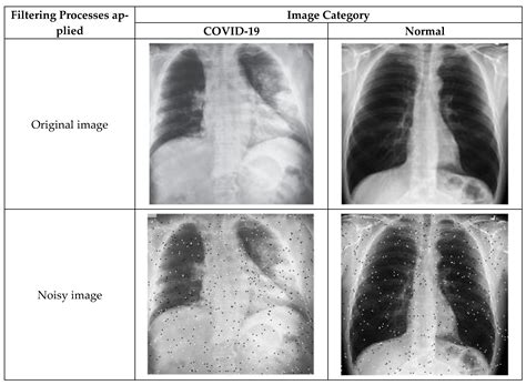 Sensors Free Full Text COVID Detection From Chest X Ray Images Using Feature Fusion And
