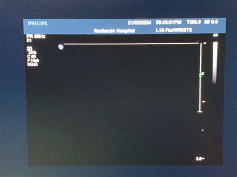 Philips L15 7io Broadband Compact Linear Array Transducer Probe Auschoice