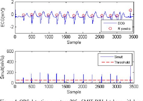 figure 1 from computationally efficient qrs detection analysis based on