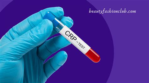 The Crucial Role Of Crp Testing In Modern Healthcare