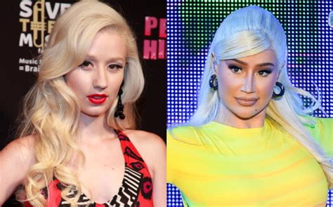 Iggy Azaleas Plastic Surgery Glow Up Has Sparked A Cosmetic Surgery Debate