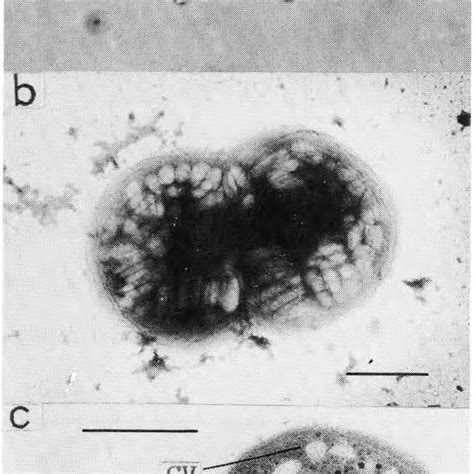 Interference Contrast Photomicrograph Of Methanobacterium Download Scientific Diagram