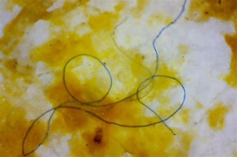 Comparison Of Microplastic Accumulation In Native And Invasive Sea