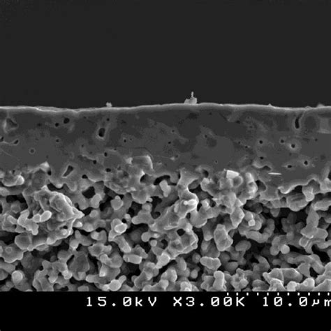 Sem Image Of A Cross Sectional Area Of Anode Supported Electrolyte Download Scientific Diagram