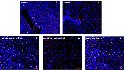 Decellularized Rat Liver Scaffolds Support Survival And Metabolic