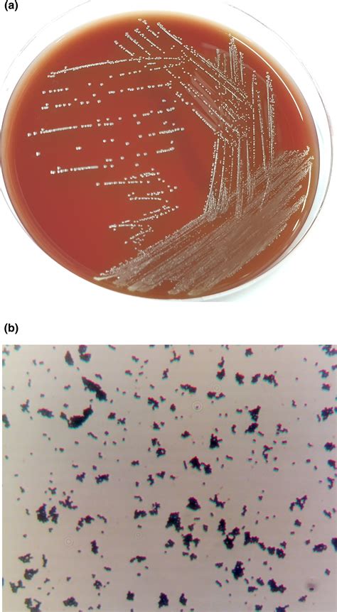 Characteristics Of Aerococcus Viridans Isolated From Porcine Fetuses In Korean Farms Nguyen Characteristics Of Aerococcus Viridans Isolated From Porcine Fetuses In Korean Farms Nguyen