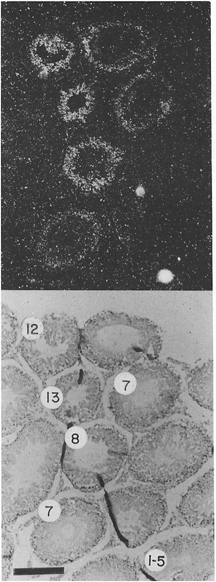 Cytochemical Localization Of Tp1 Mrna By In Situ Hybridization The