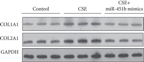 Overexpression Of Mir 451b Or Knockdown Of Rhoa Decreased The Effect Of Download Scientific