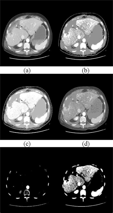 figure 4 from a framework for multi threshold image segmentation of low