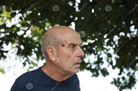 Shocked Elderly Man Loses Orientation And Forgets Everything In Nature