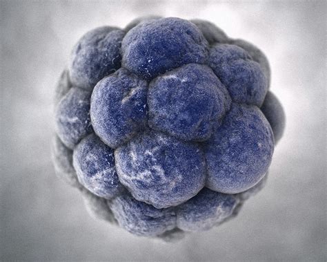 بیولوژیست های ایرانی Iranian Biologists شناسایی مکانیسم بیماریزایی