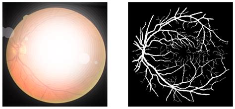 retinal vessel segmentation using pytorch semantic segmentation