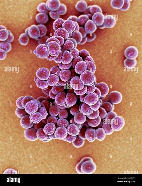 MRSA Bacteria Coloured Scanning Electron Micrograph SEM Of Methicillin Resistant